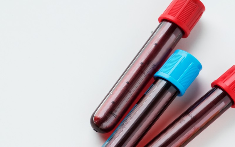 Breakthrough: Single blood test shows promise in detecting dozens of ...